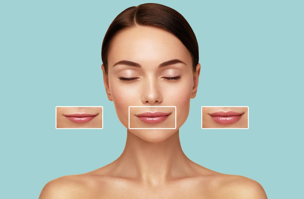 How Long Does Lip Filler Last? Tips for Long-Lasting Results