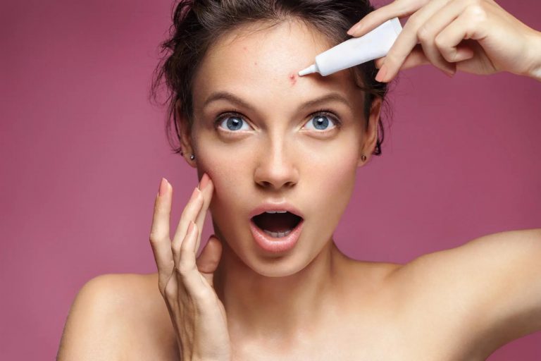 Acne Face Map: What Your Breakouts Reveal About Your Skin